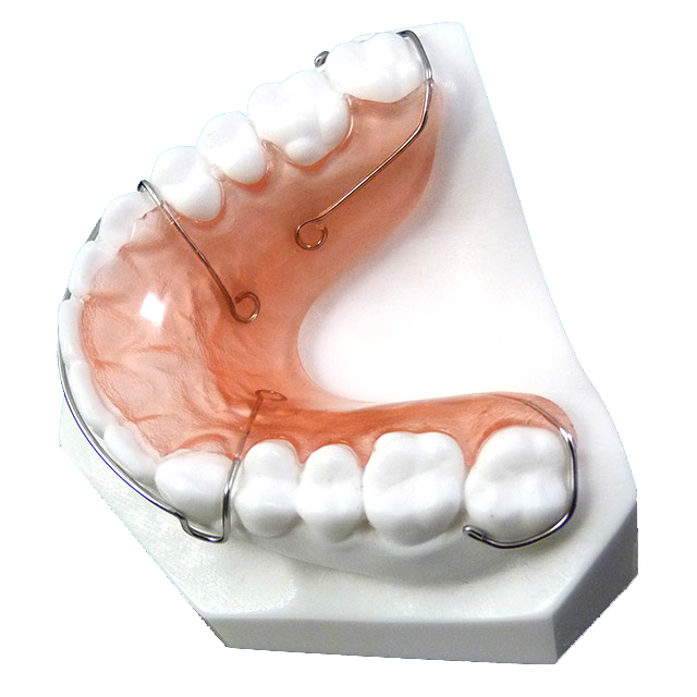 Retension Appliances || Smile Stones Dental Pvt Ltd